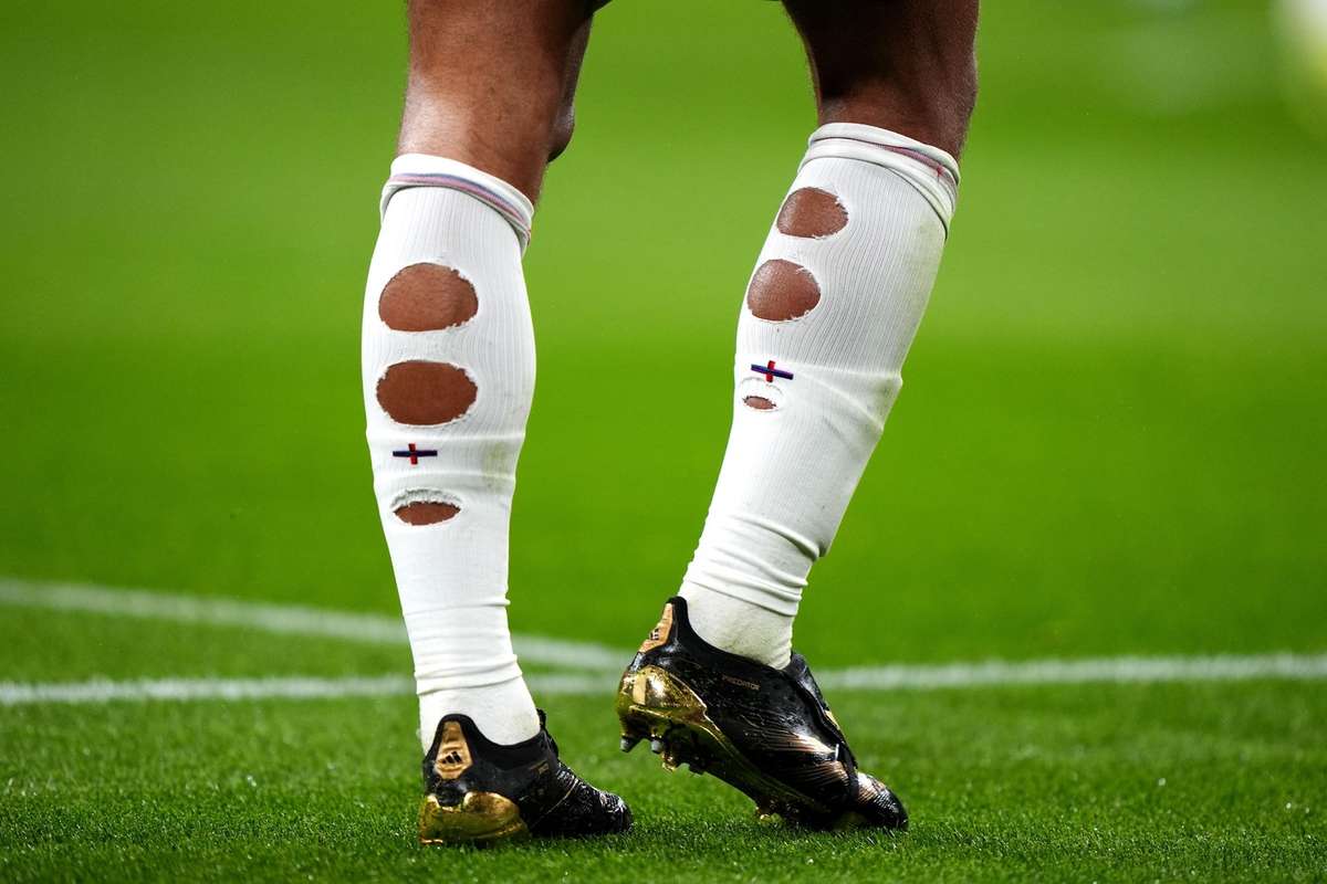 Exploring the popular trend of footballers cutting holes in their socks ...