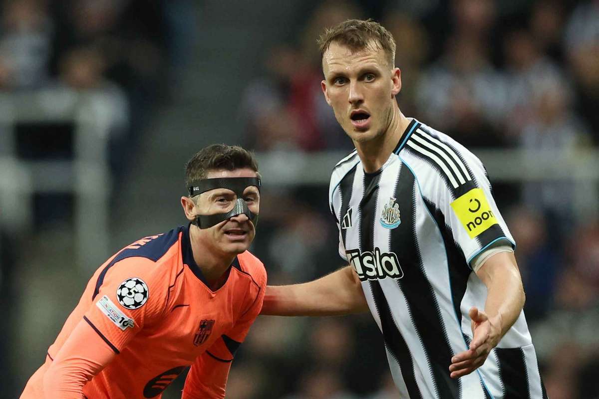 Burn rallies Newcastle squad as he admits chances of UCL are "pretty ...